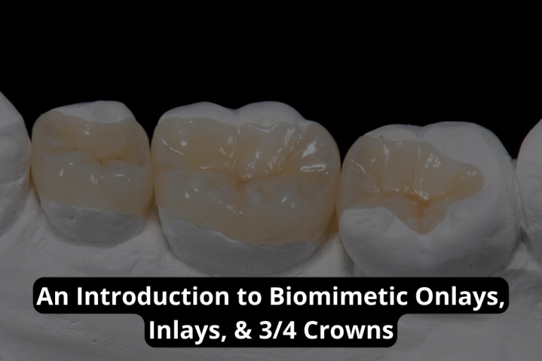 An Introduction to Biomimetic Onlays, Inlays, & 3/4 Crowns - Central ...