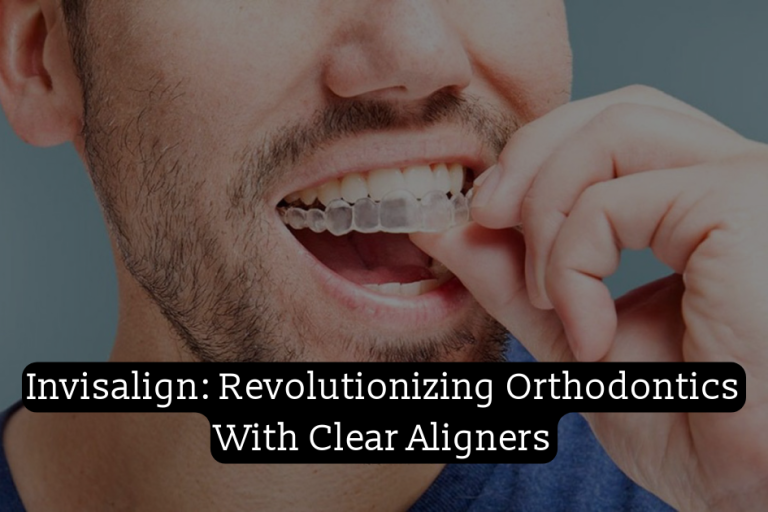 Invisalign: Revolutionizing Orthodontics With Clear Aligners - Central Kansas Dentistry